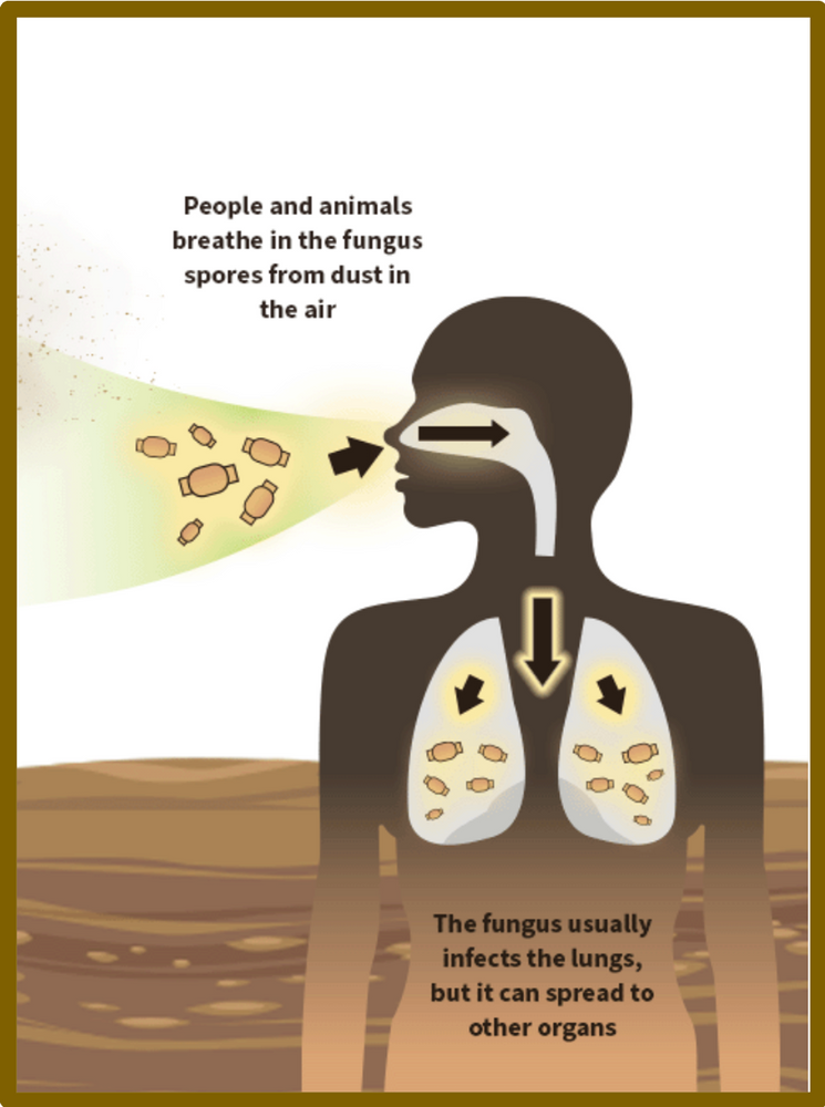 Cocci Chronicles Part II-Airborne Fungus