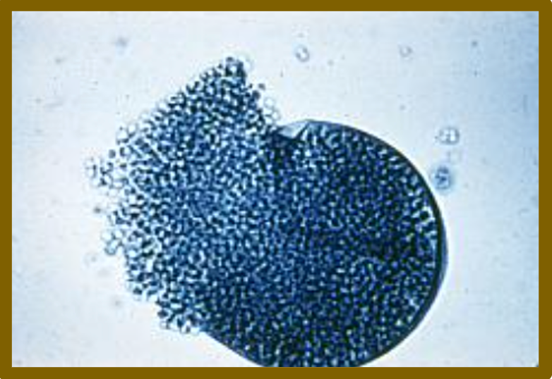 Cocci Chronicles Part II-Airborne Fungus