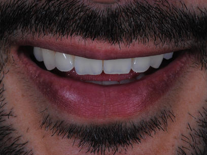 Gallery | Dentistry180