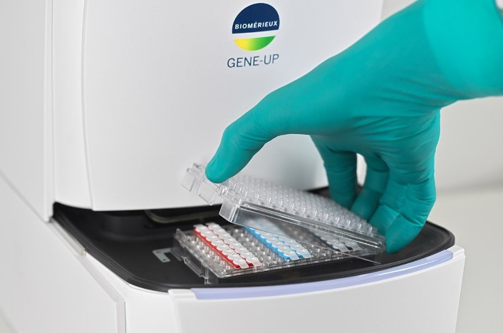 O fluxo de trabalho simples fica ainda mais fácil com o novo formato do ...