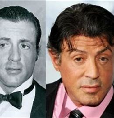 Sylvester Stallone's Hair Loss and Transformation: The Story Behind His ...