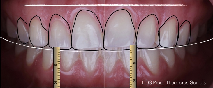 Aesthetics | Advanced Dental Laboratory Maria Spanopoulou | Athens