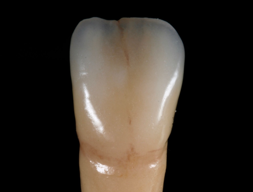 Advanced Dental Laboratory, Maria Spanopoulou