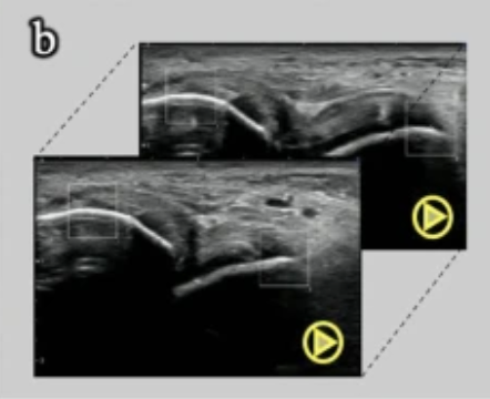 Reliability and validity of ultrasonographic automated length ...