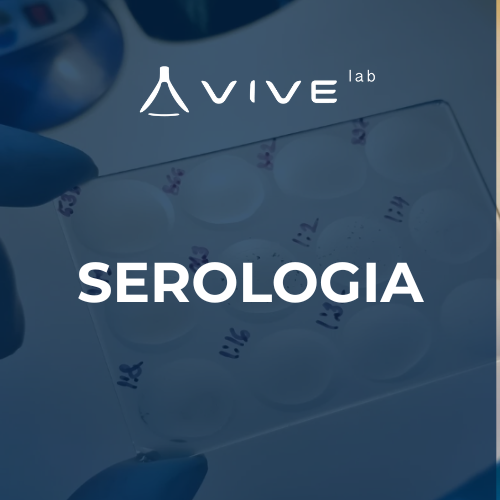 HIV 1+2 ANTICUERPOS Y ANTÍGENO P24 (4TA GEN.) CUANTITATIVO | VIVE LAB