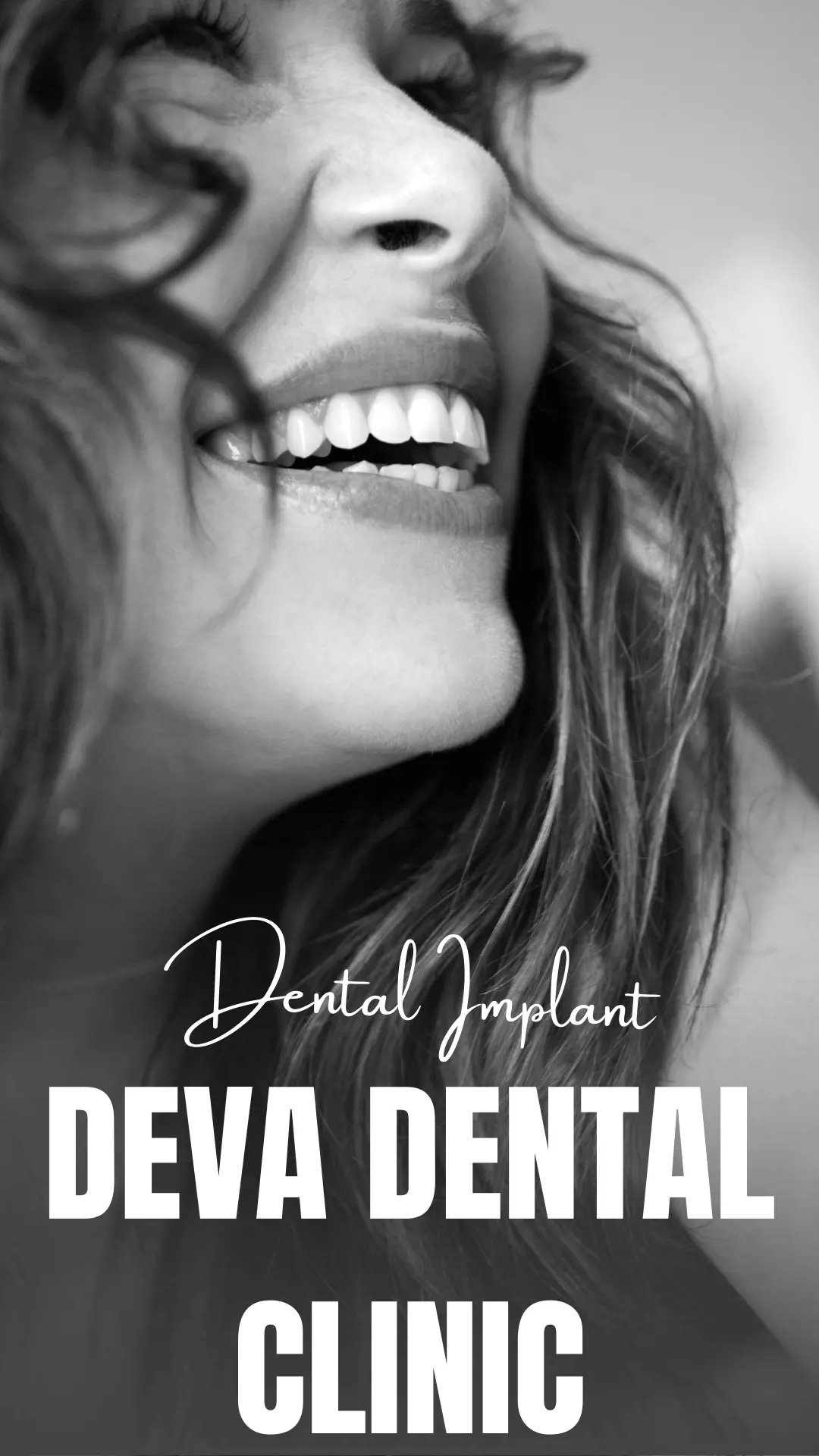 Exploring Full Mouth Dental Implants in Izmir, Turkey