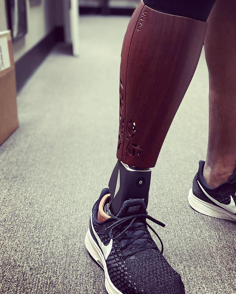 Custom made socket cover | Ortheco Prosthetics