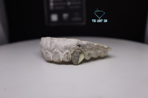 Half VS white gold cap | TheLightSho