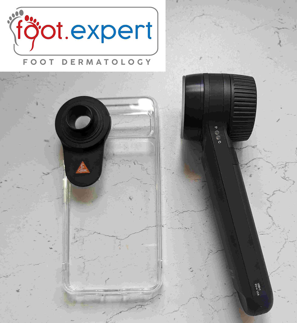 A review of the new HEINE DELTA 30 PRO Dermatoscope
