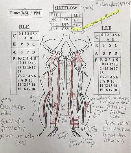 Vein Treatment | Cardio Consultants