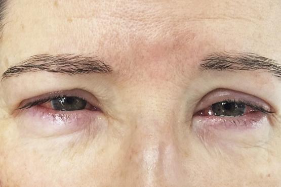 Pathologies | Conjonctivite | Dr Leroy