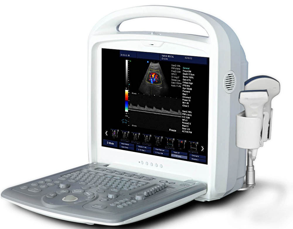 GT3 RENKLİ DOPPLER ULTRASON