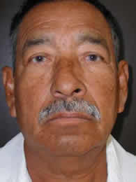 Photo Gallery | Soper Brothers