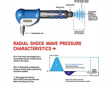 What is Shockwave Therapy | Auckland Shockwave Therapy