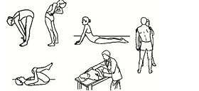 what is the mckenzie method for sciatica