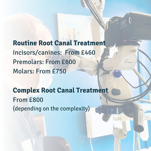 Root Canal Fillings | The High Street Dental Practice | Chippenham