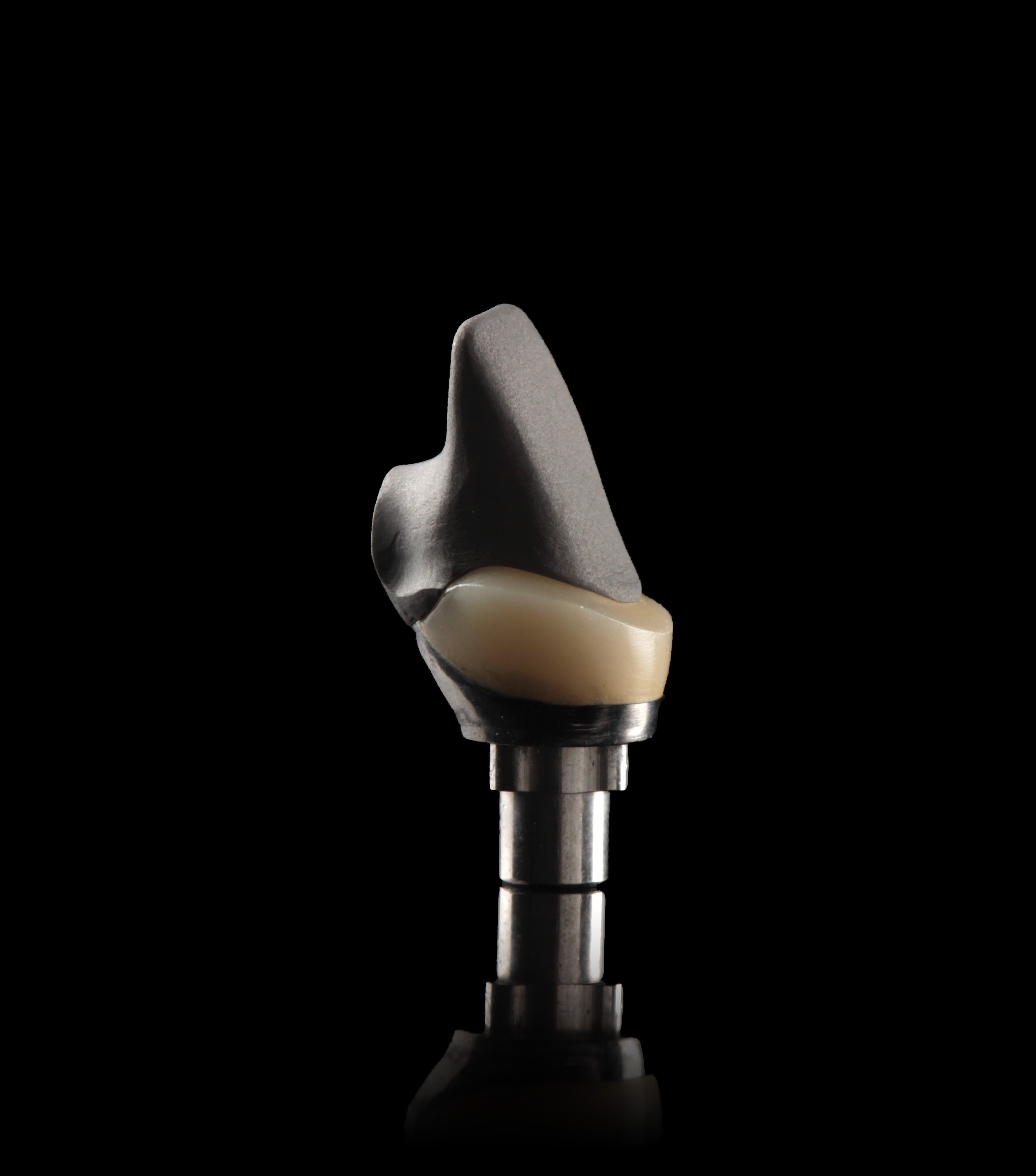 PFM restorations | Szabi Hant MDT