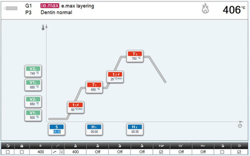 My e.max Ceram firing programs | Szabi Hant MDT
