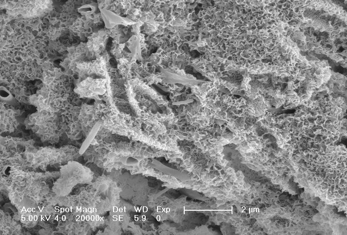 Fusobacterium nucleatum - BacteriOncolog | laboratory