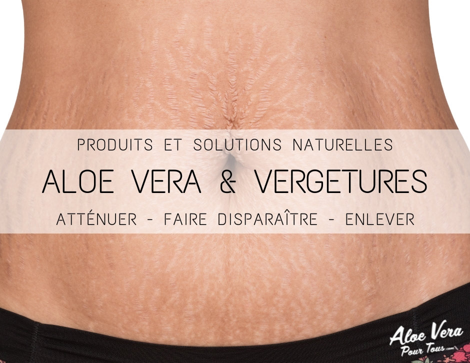 Aloe Vera et Vergetures | Comment Atténuer, Enlever, Faire disparaitre ...
