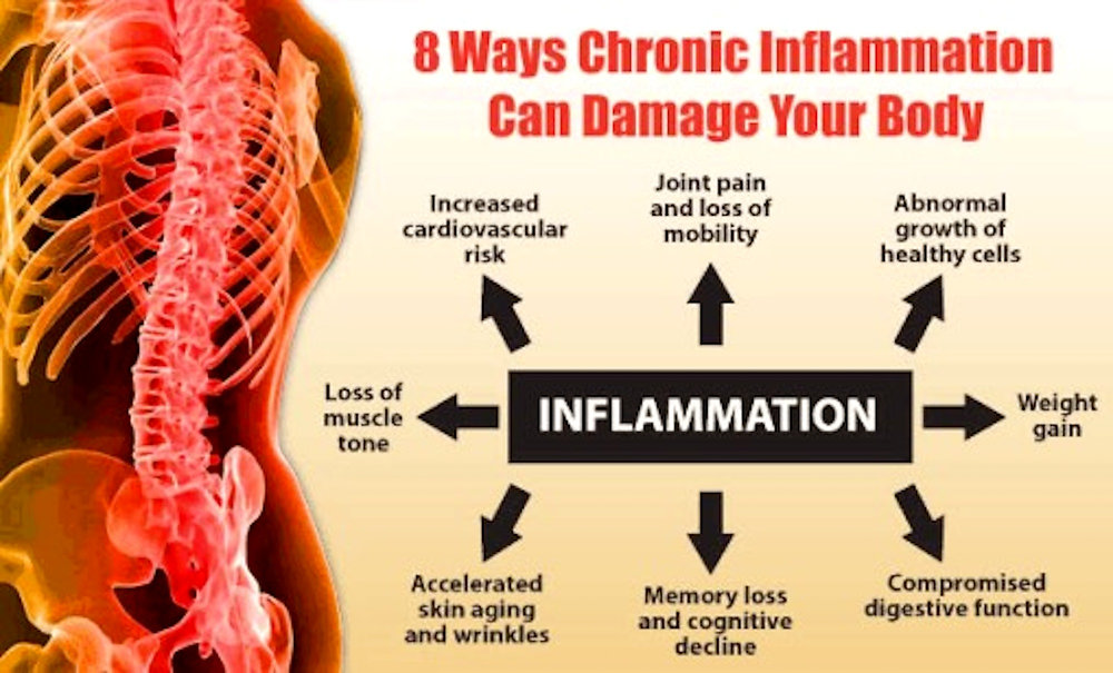 Sugar: "Why is it So Bad For Me?"Excessive intake of sugar affects the ...