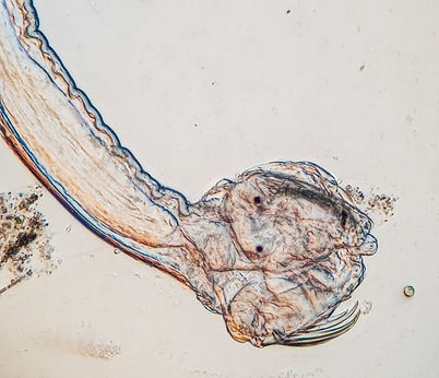 ArrowWorms | Marineplankton