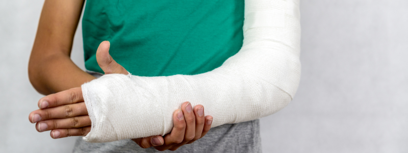 Adaptive Clothing for a Broken Arm - How to Get Dressed with a Broken Arm