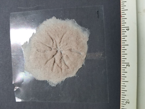 Prosthetic Transfer 017 - Healed Scar | Shelly's Artspace