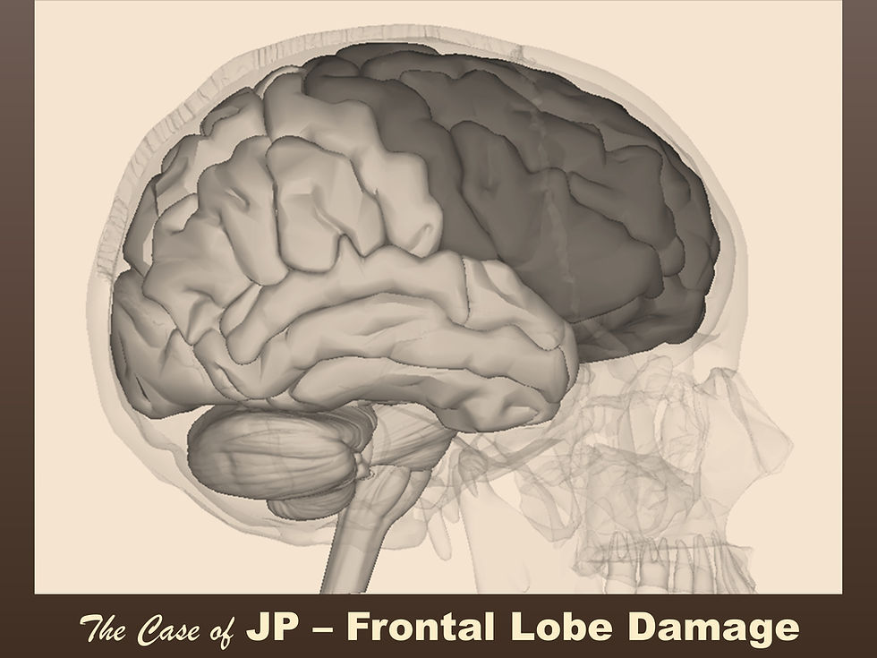 The Case of JP - Effects of Frontal Lobe Damage on Personality