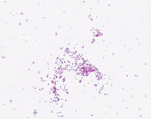 Corynebacterium singulare GMB0062 | GMBANK