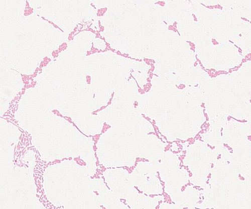 Morganella morganii GMB0555 | GMBANK