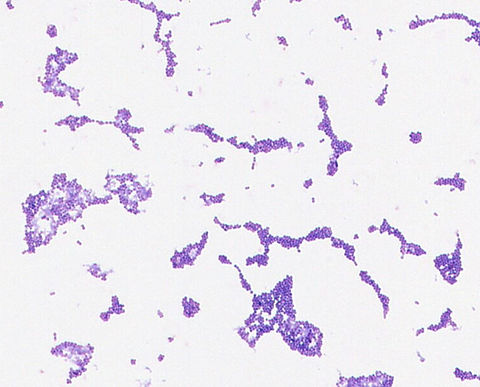 enterococcus gallinarum