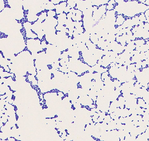 Lancefieldella rimae GMB0010 | GMBANK