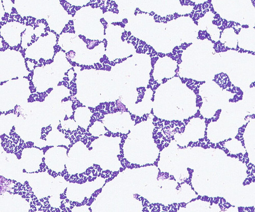 Aerococcus sanguinicola GMB0157 | GMBANK