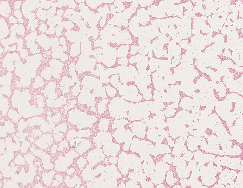 Streptococcus anginosus GMB0775 | GMBANK