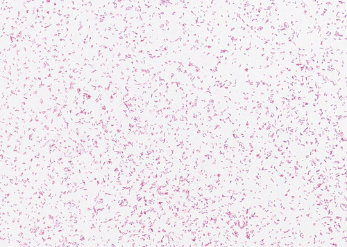 Plesiomonas shigelloides GMB1703 | GMBANK