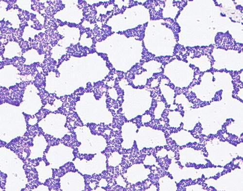 Enterococcus avium GMB1269 | GMBANK