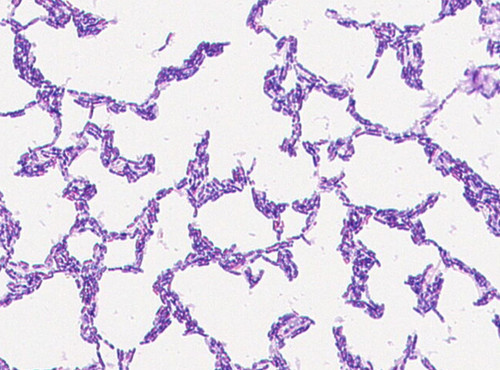 Bacillus toyonensis GMB1331 | GMBANK