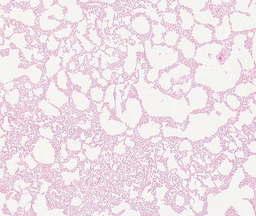 Cetobacterium somerae GMB0071 | GMBANK