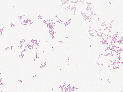 streptococcus salivarius hemolysis