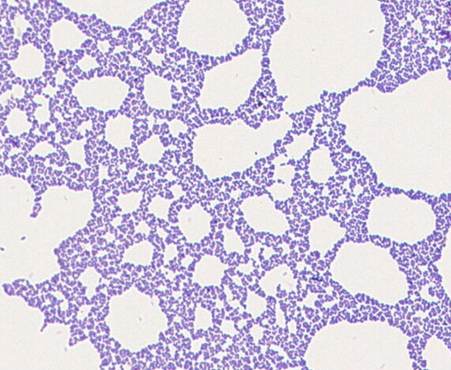 Cutibacterium acnes GMB1680 | GMBANK