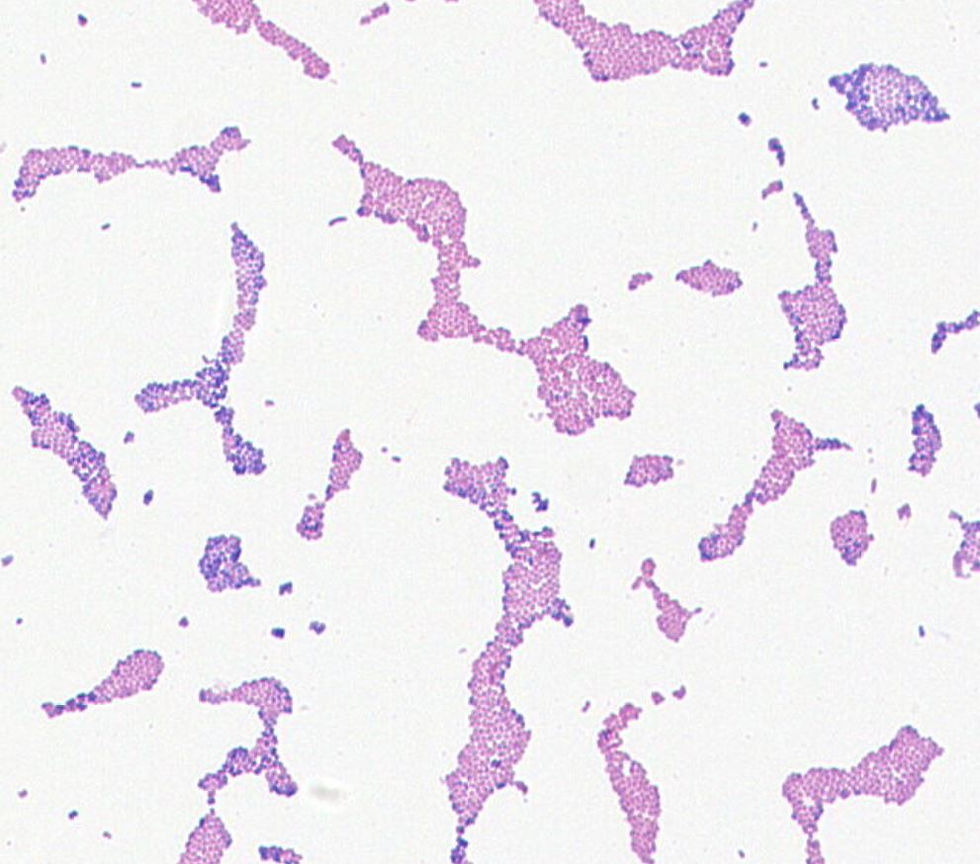 Lactococcus garvieae GMB0765 | GMBANK