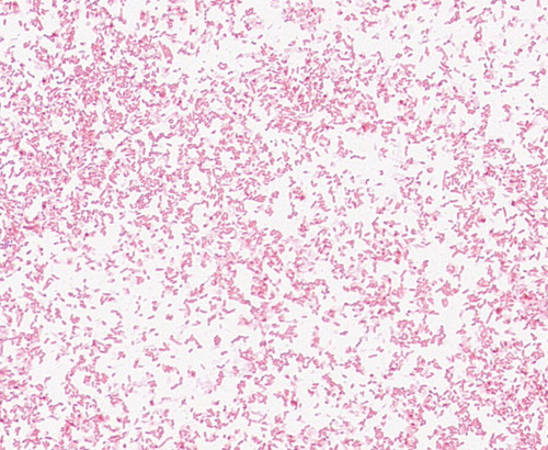 Plesiomonas shigelloides GMB1702 | GMBANK