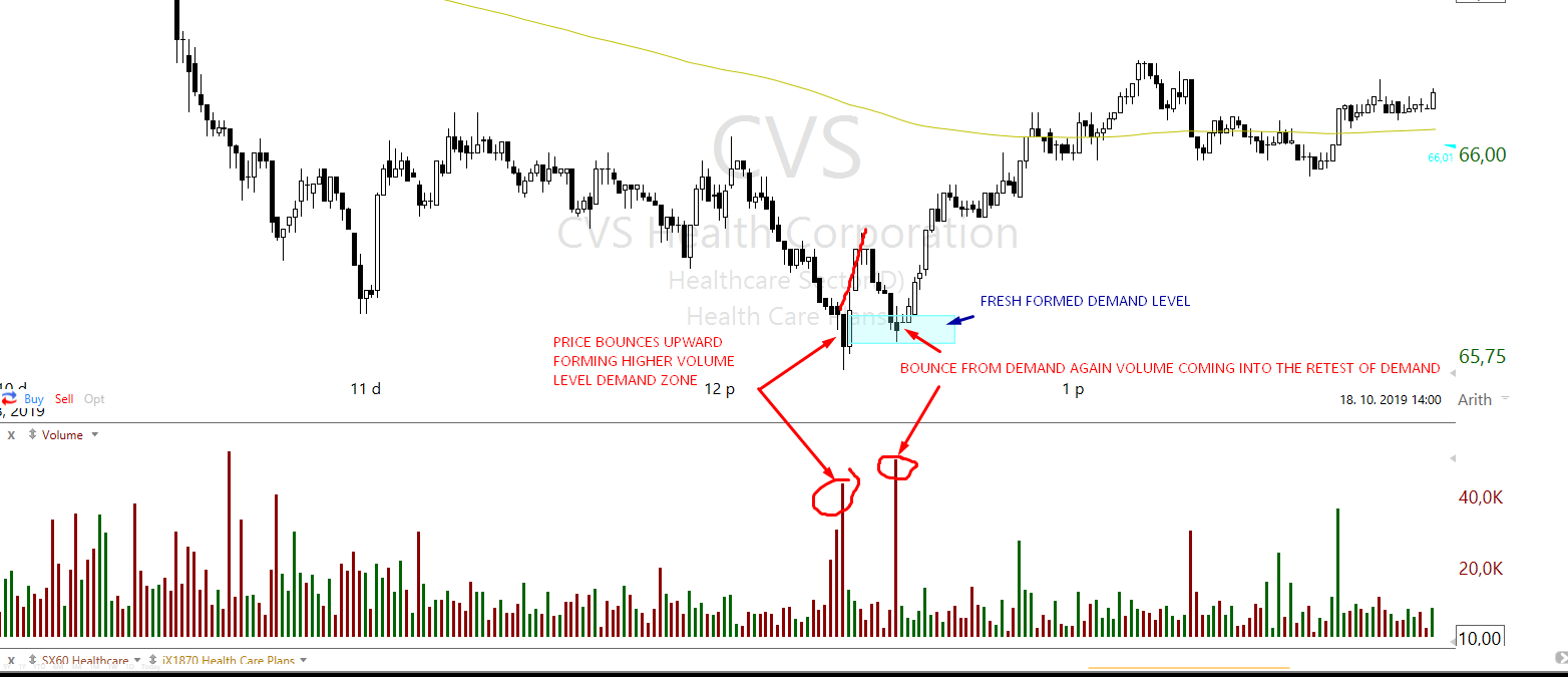 Supply and demand zones