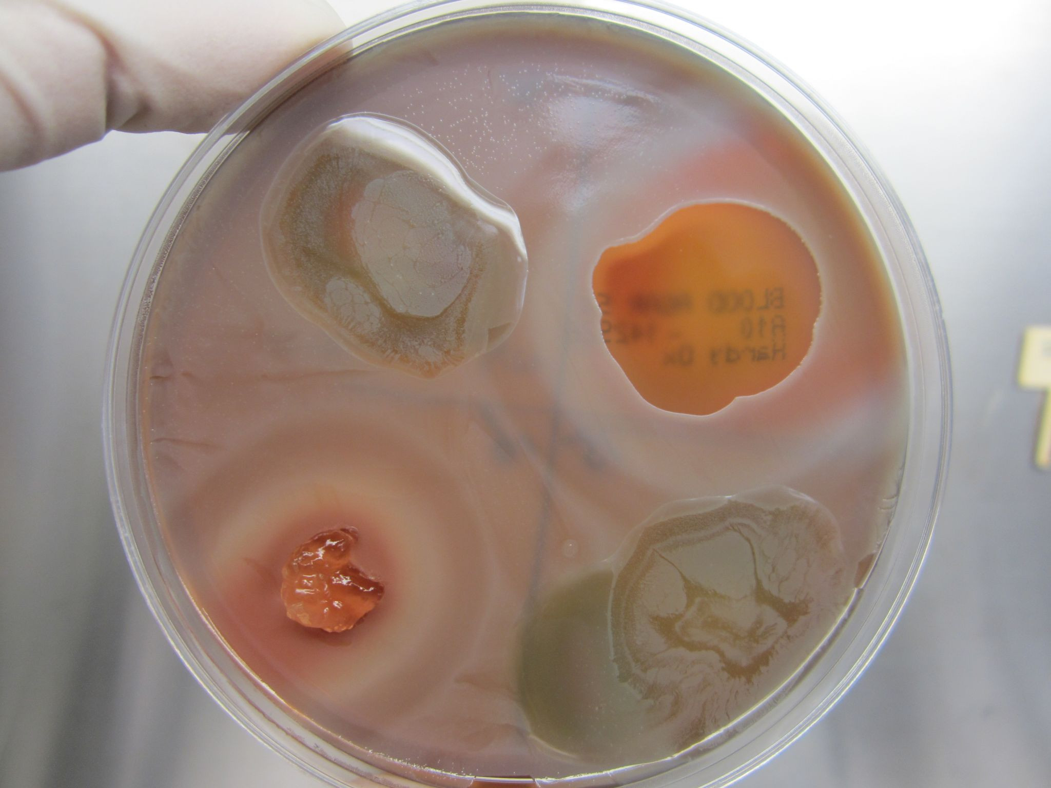Microbial Barrier Testing of Novel Composite Dressings