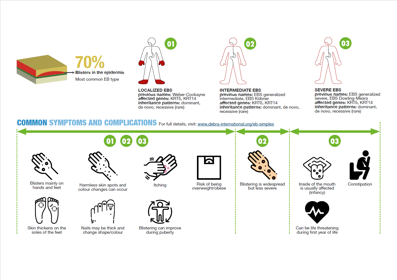 EB simplex (EBS) | DEBRA International