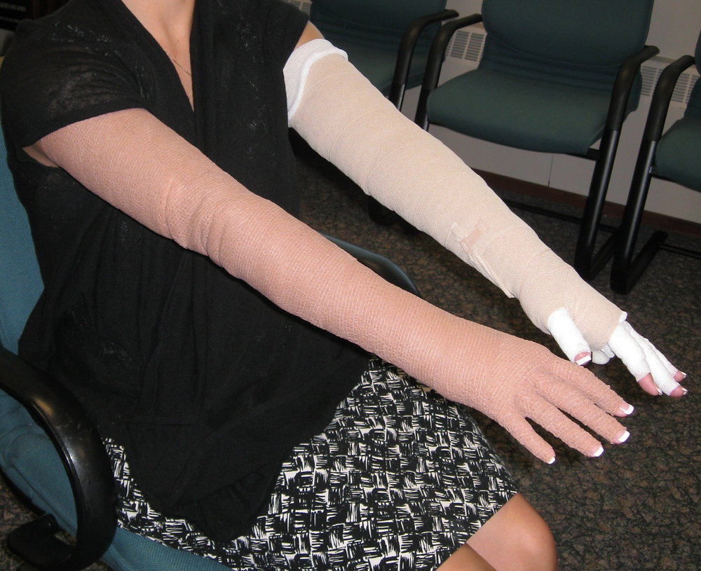 Compression Therapy