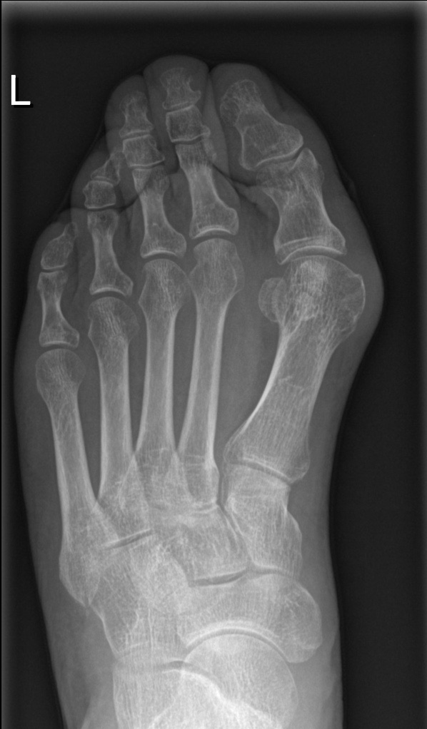 Mortons Nevrom | Fot & Ankel Spesialisten | Fjøsangerveien