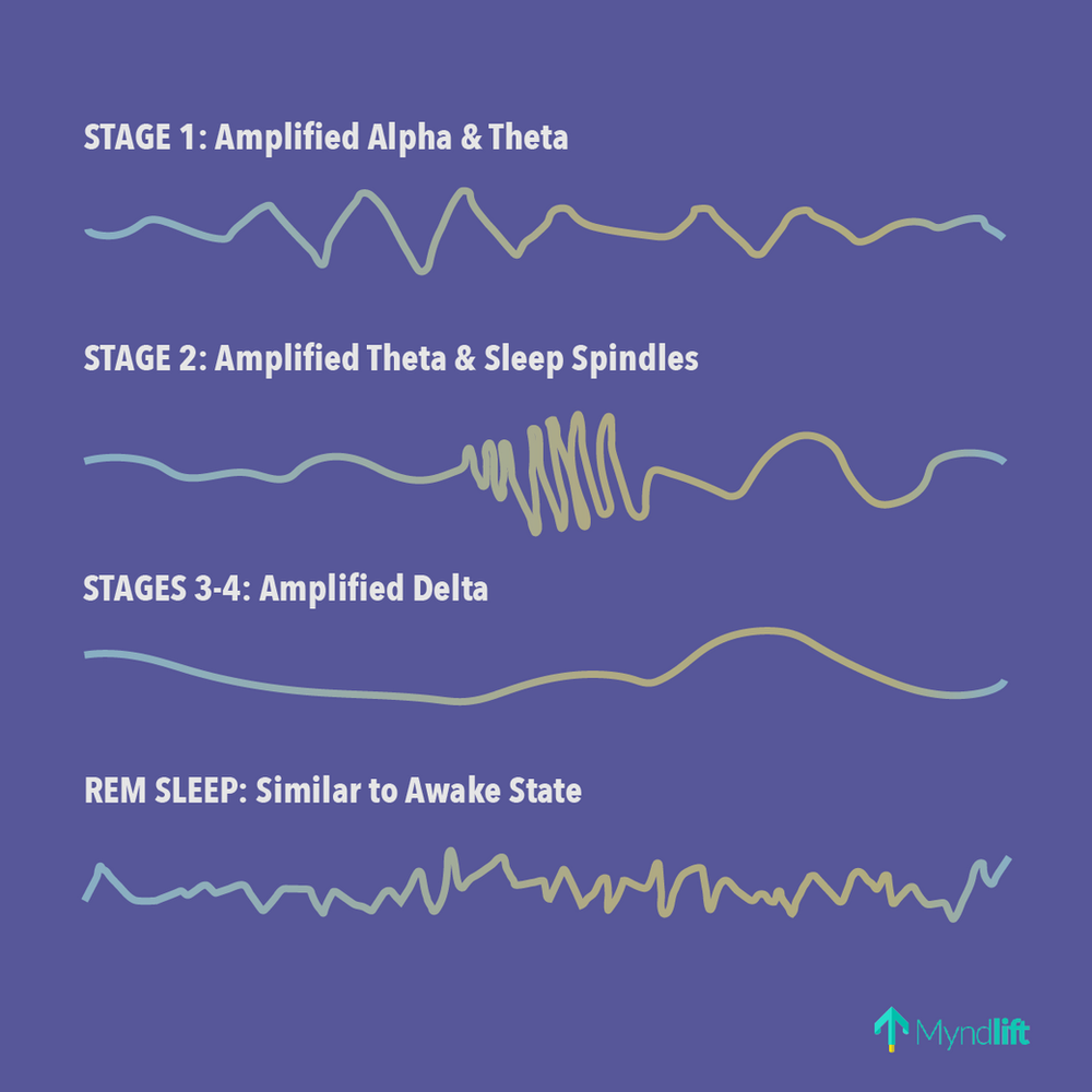 Brainwaves, Sleep, and Better Brain Health