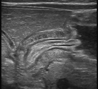 ECOGRAFIA PILORICA | Dott. El-Dalati